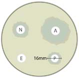 Advanced Bacteria Project: Gram Staining and Antibiotics