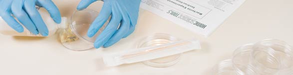 Agar and Petri Dishes Science Lesson